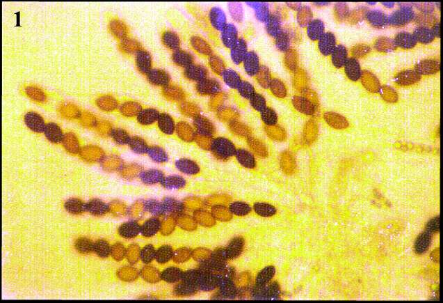 Sordaria Lab Pictures - BIOLOGY JUNCTION