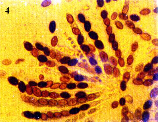 Sordaria Lab Pictures - BIOLOGY JUNCTION
