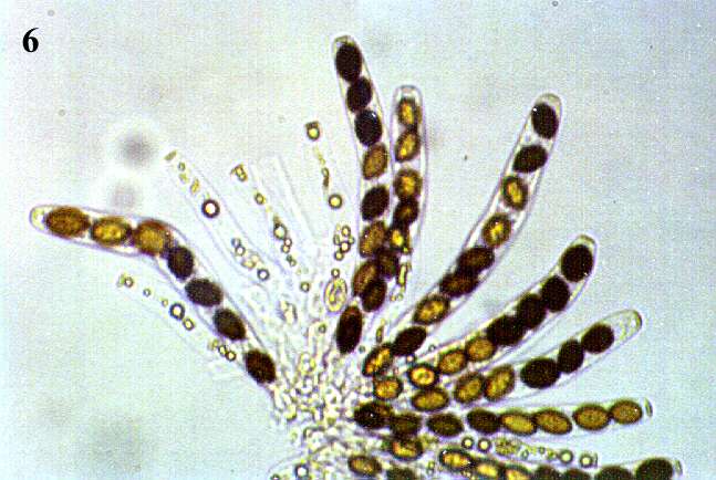 Sordaria Lab Pictures BIOLOGY JUNCTION sordaria-lab-pictures-biology-junction