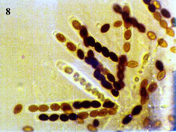 Sordaria Lab Pictures - BIOLOGY JUNCTION